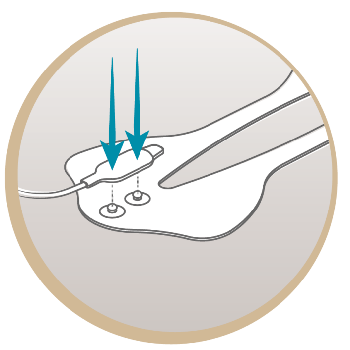 Buy ELITONE | Incontinence Treatment at Home Reduces Leaks